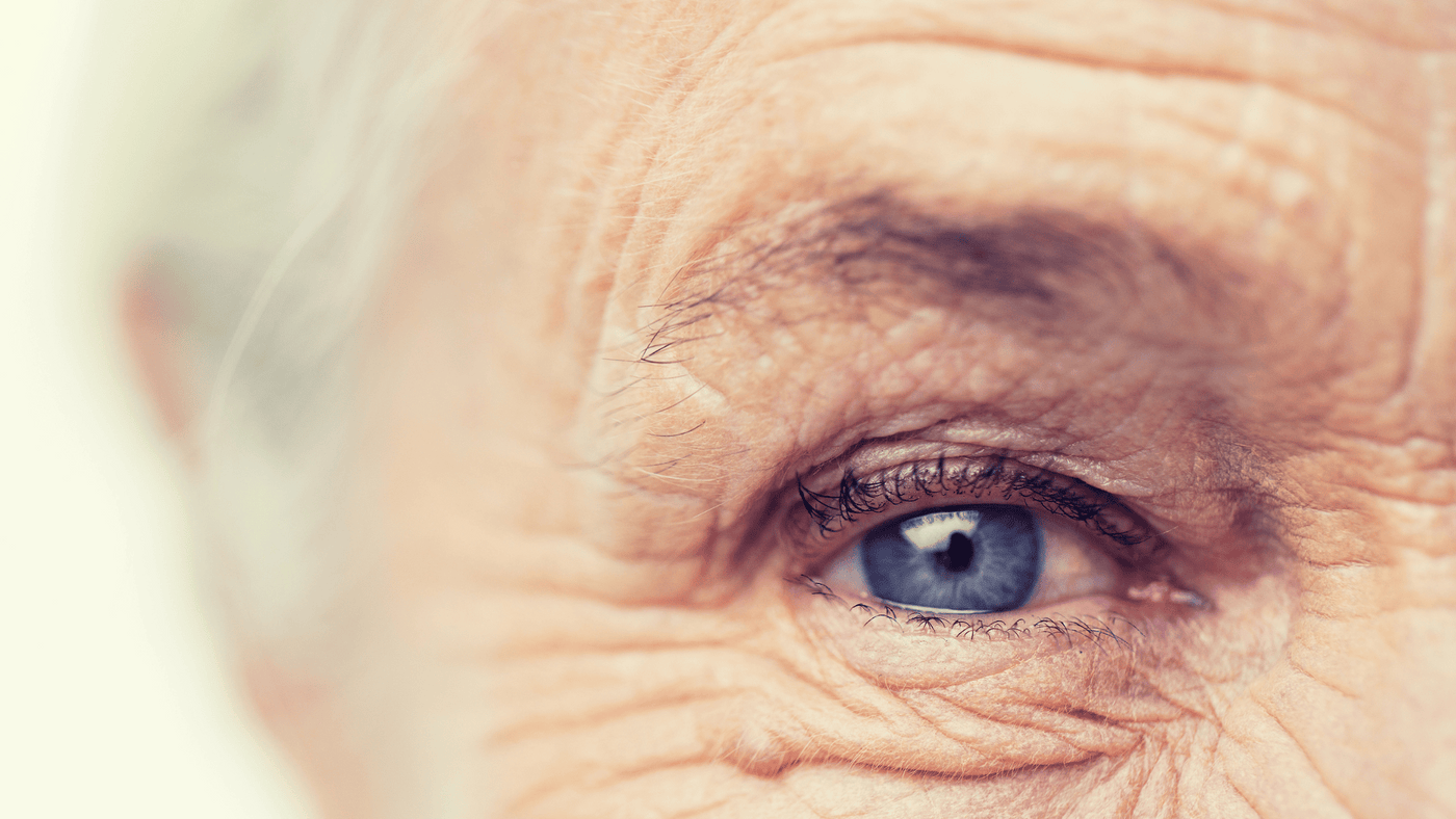 Secrets to Youthful Skin: 8 Ways to Prevent Wrinkles - AgeMate